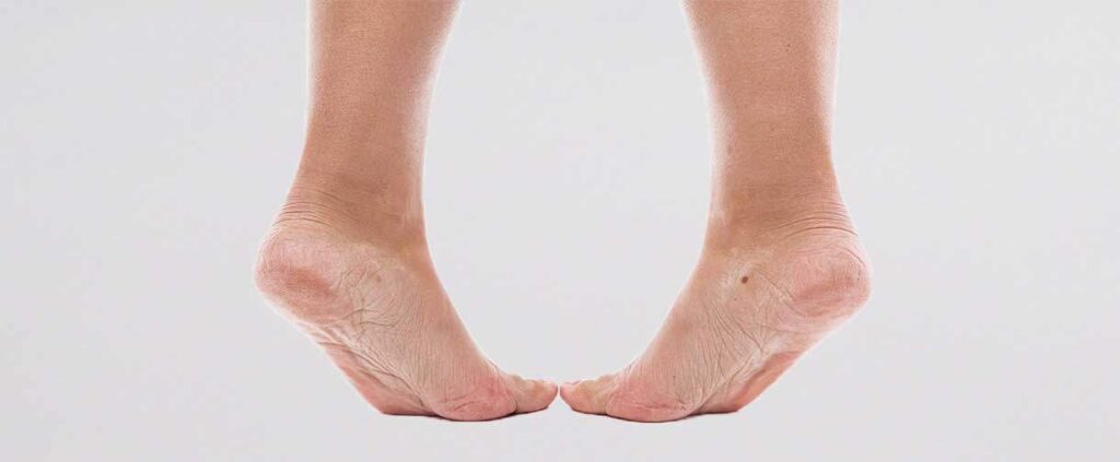 Fat Loss and Foot Pain