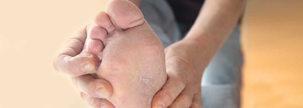 Get Your Feet Sandal Ready - Simple Tips & Tricks! - BioPed Footcare