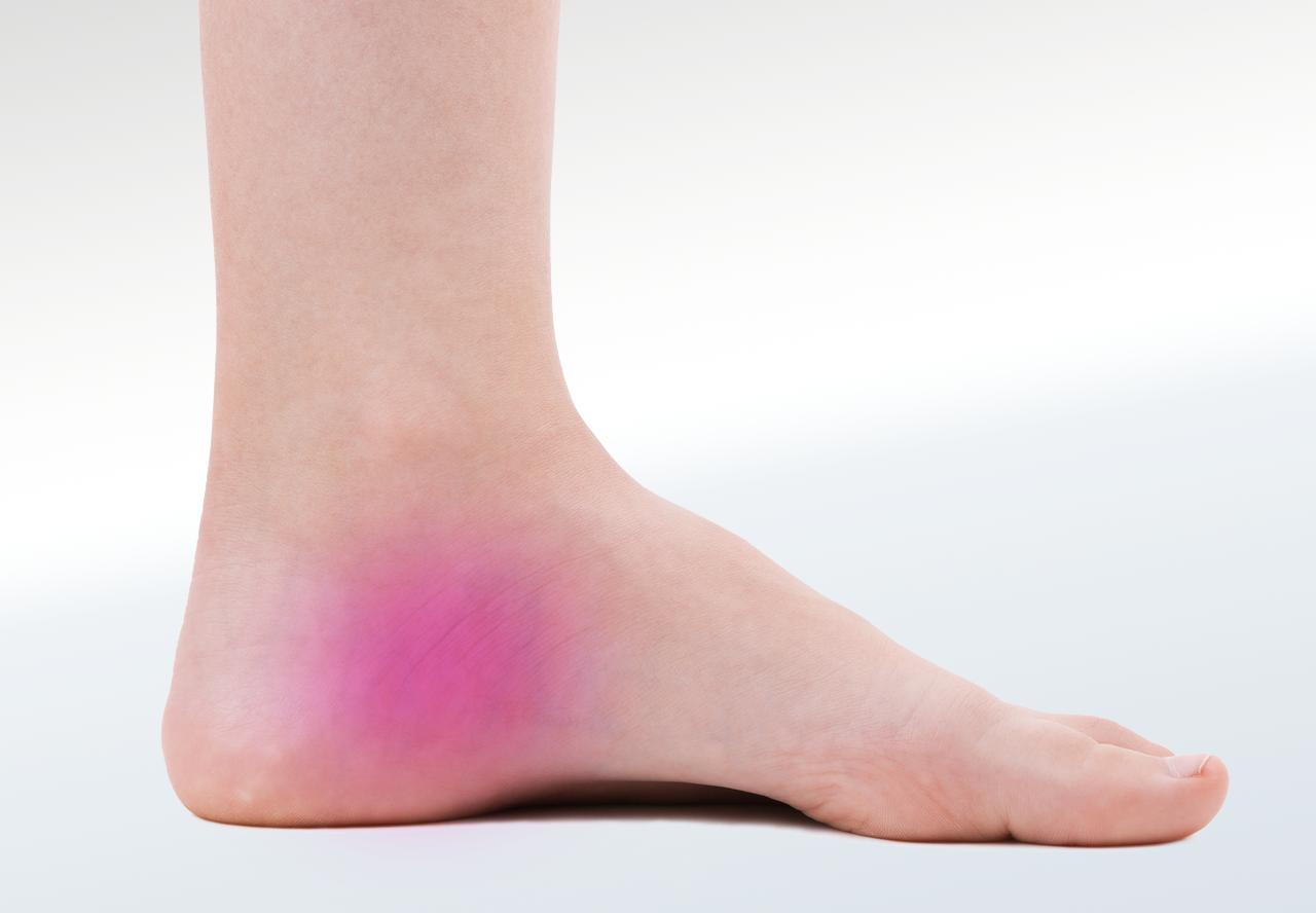 Tarsal Tunnel Syndrome - Relieve Foot Pain & Leg Pain