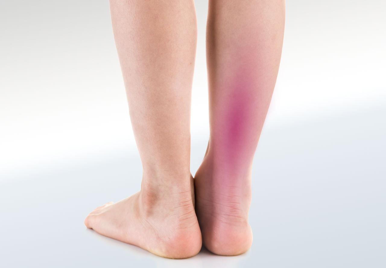 Achilles Tendinitis/Tendinosis/Tear - Relieve Foot Pain & Leg Pain