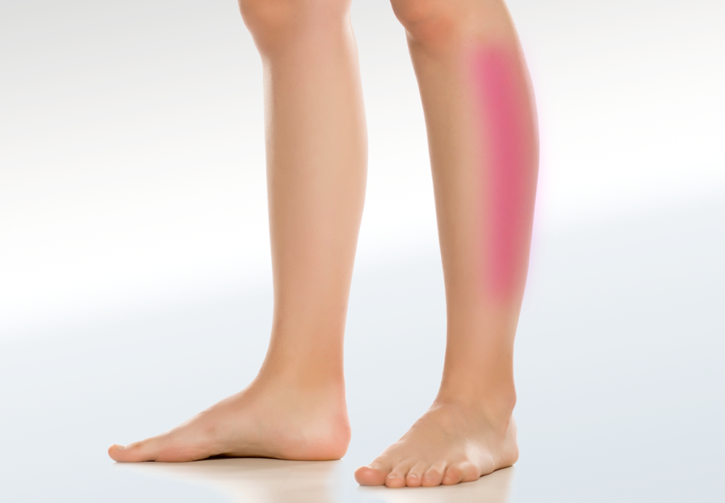 Leg Pain/Lateral - Relieve Foot Pain & Leg Pain
