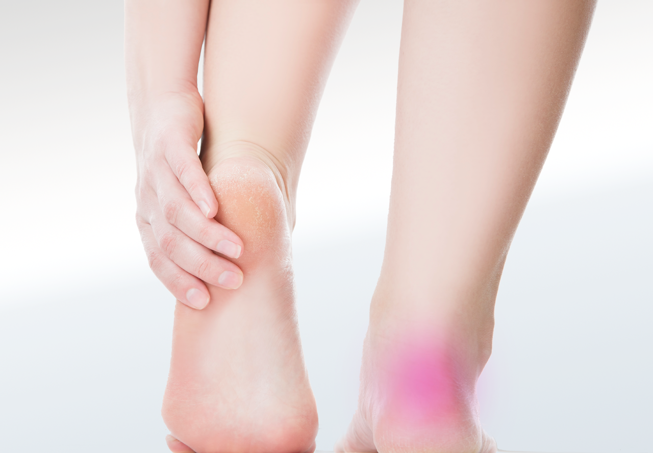 Sever’s Apophysitis - Relieve Foot Pain & Leg Pain