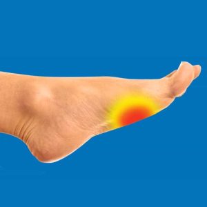 Forefoot Varus - Relieve Foot Pain & Leg Pain